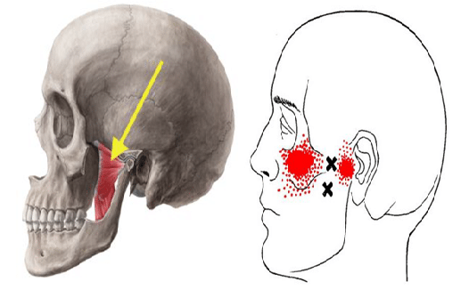 TMJ / TMD | Northern Edge Physical Therapy